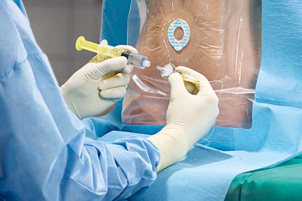 NRFit® voor regionale anesthesie - B. Braun