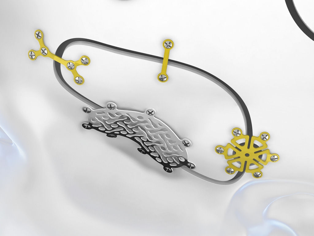 Craniale fixatie - Stabiele botflapfixatie voor elke patiënt - B. Braun