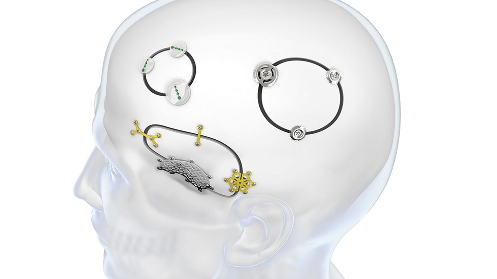 Cranial Closure Concept - B. Braun