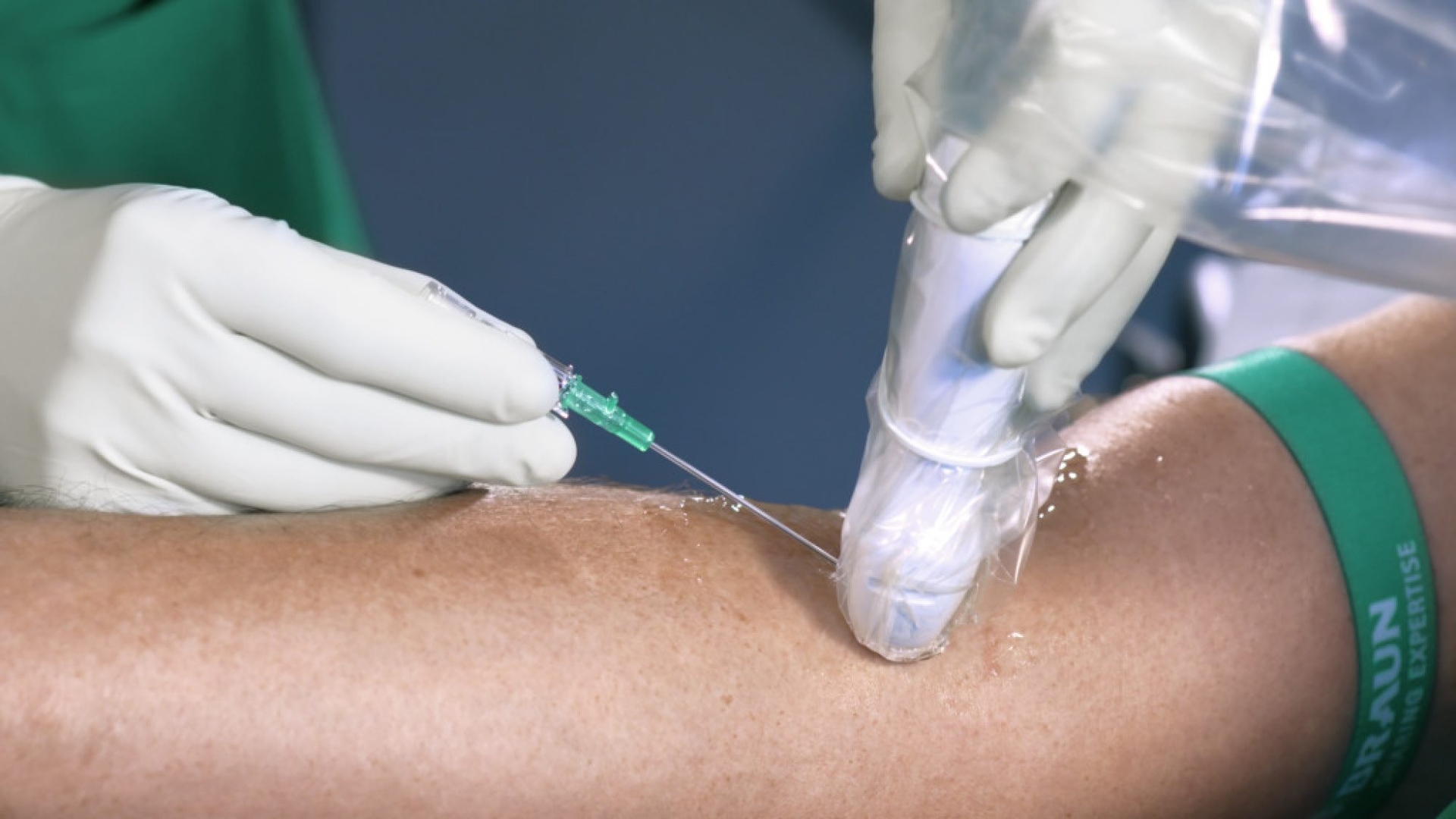 De juiste keuze voor vasculaire toegang bij infuustherapie - B. Braun