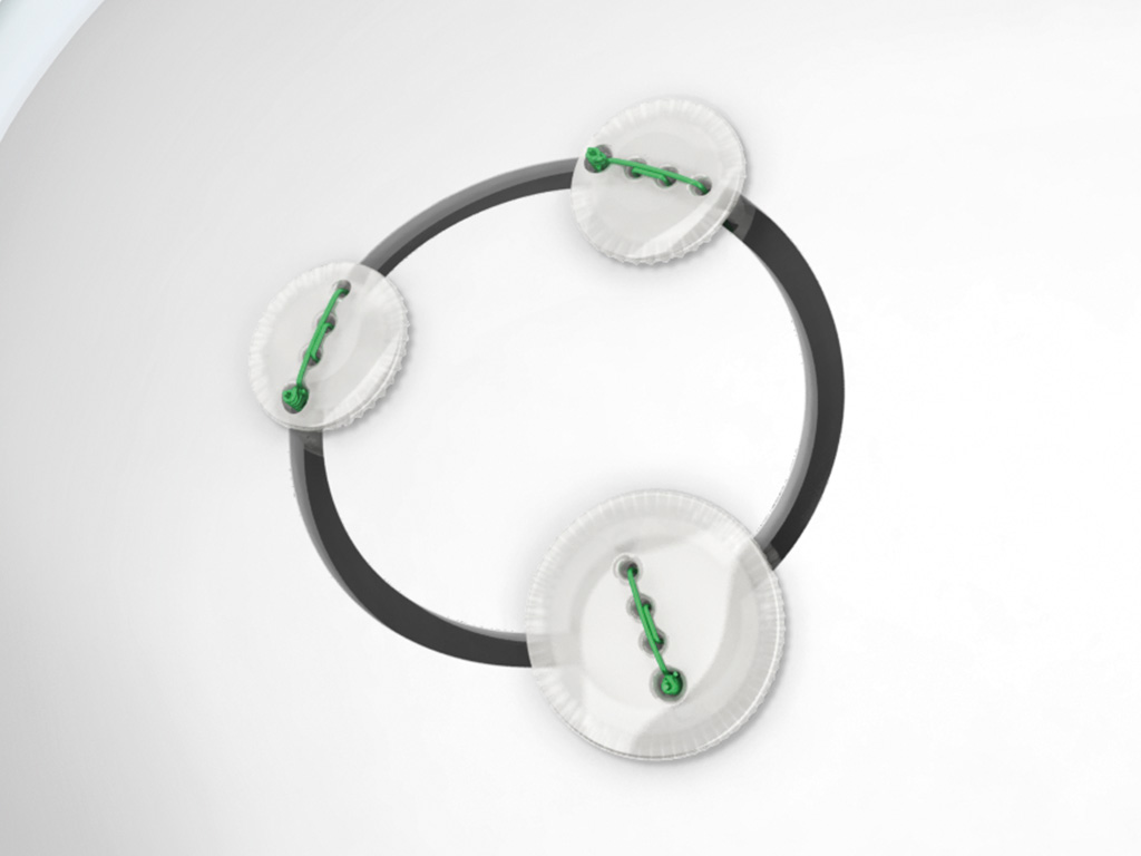 Craniale fixatie - Stabiele botflapfixatie voor elke patiënt - B. Braun