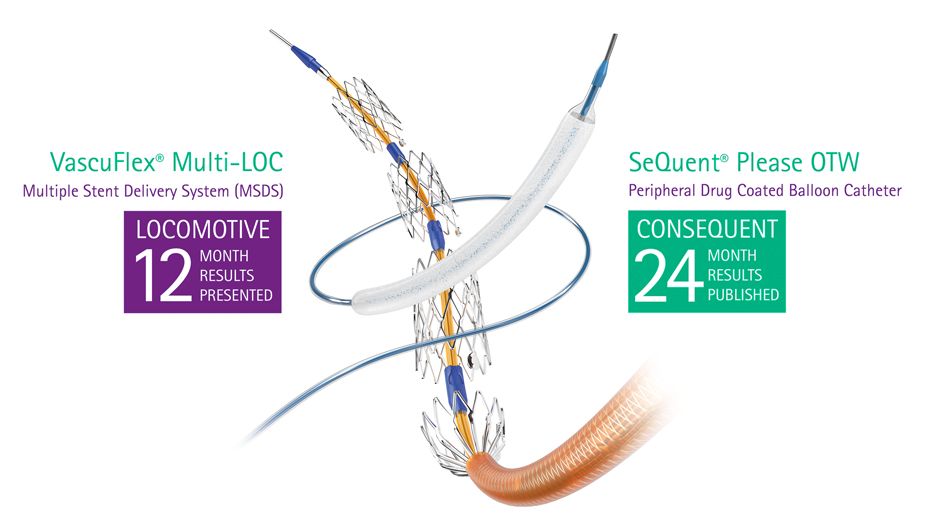 Perifere angioplastiek - Combinatietherapie voor endovasculaire procedures