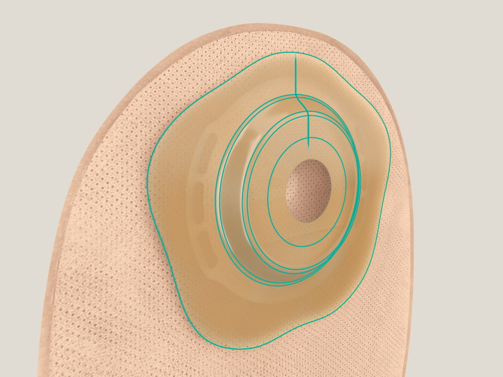 Convex stomamateriaal tegen stomalekkages - B. Braun